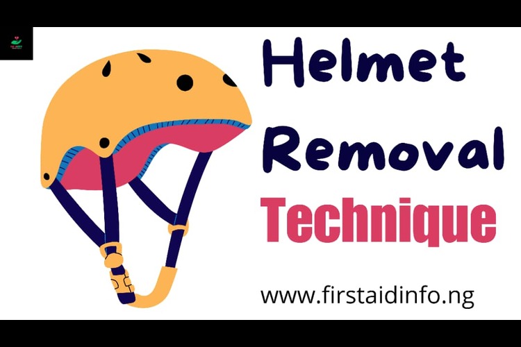 Helmet Removal Technique - FirstAidinfo Helmet Removal Technique - FirstAidinfo